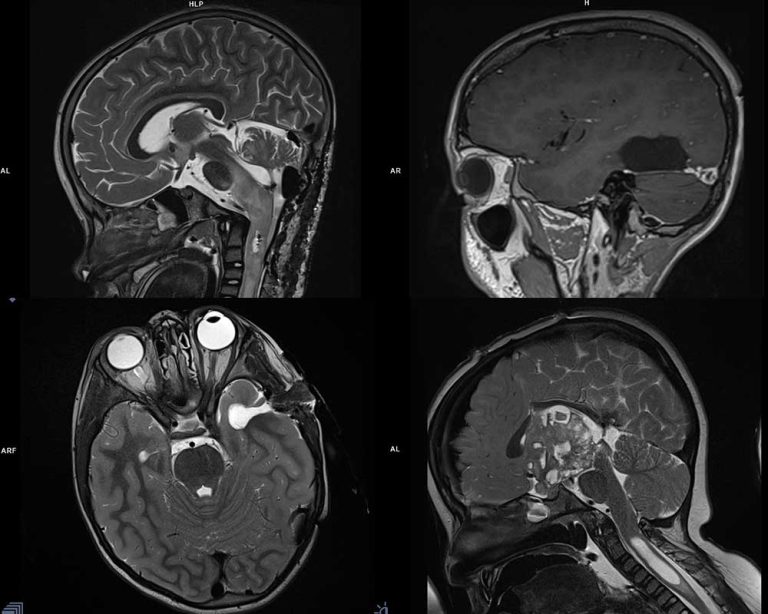 IMRIS – Confidence Visualized
