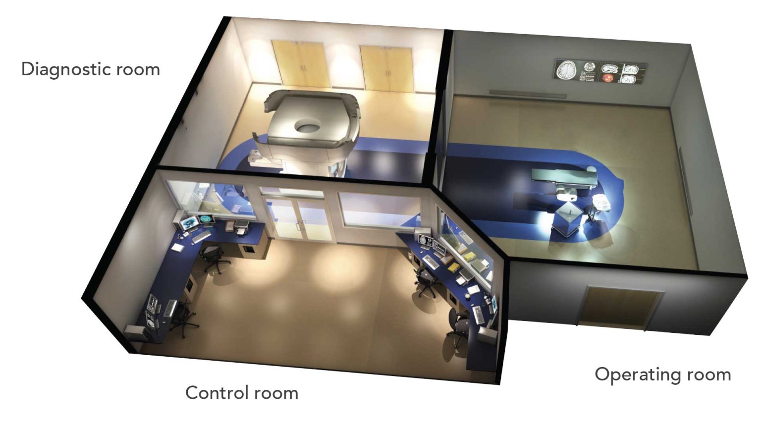 System Configurations – IMRIS